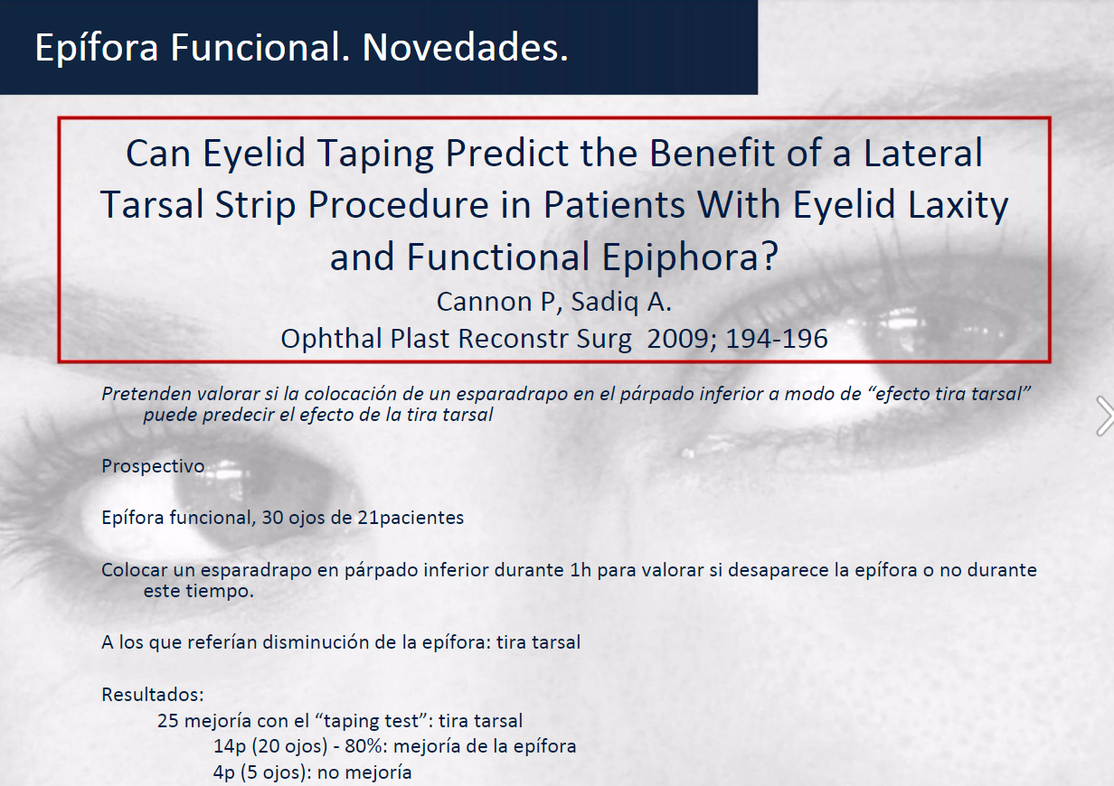 Epífora funcional o por qué llora el ojo de la catarata - FacoElche.com