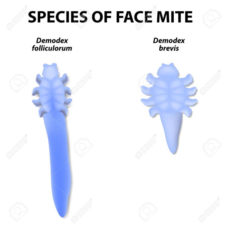 Demodex: Manejo y tratamiento - FacoElche.com